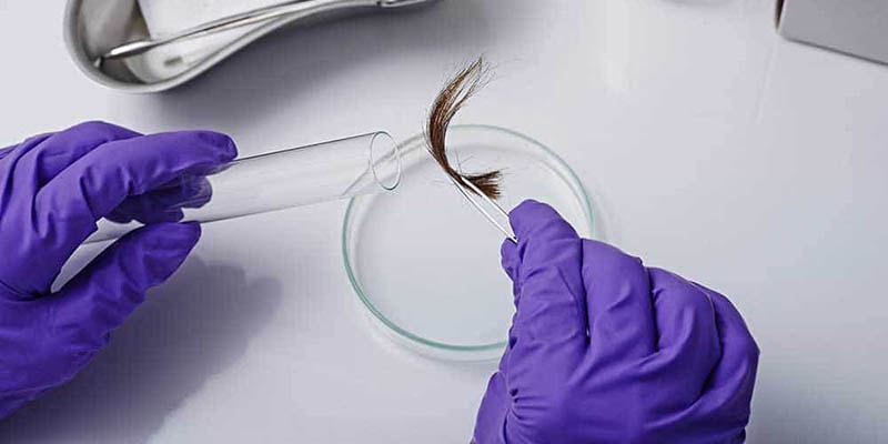 Toxicológico - AlphaClin Diagnósticos